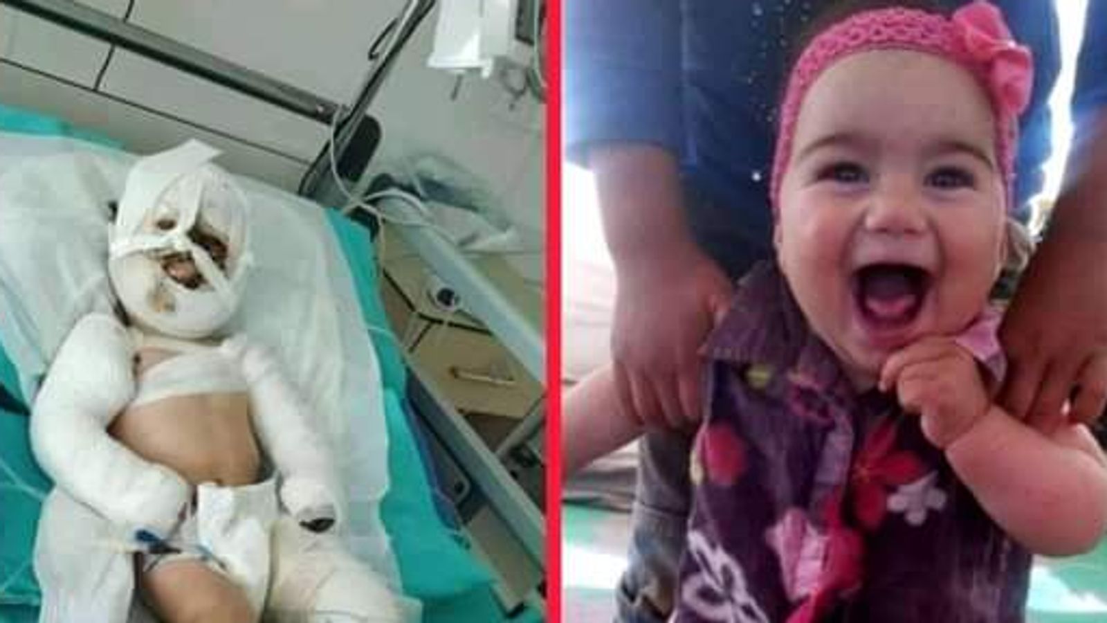 ‘Bebê milagroso’ queimou no fogo de uma barraca, superando todas as ...