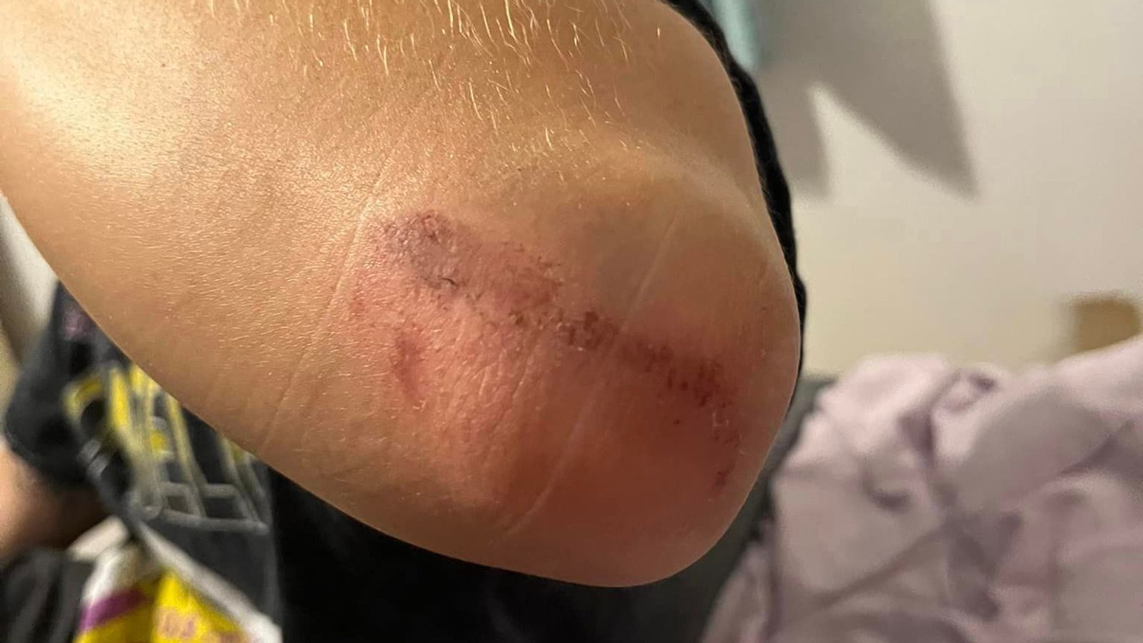 Woman 'terrified' to return to downtown area after 'homophobic' attack ...