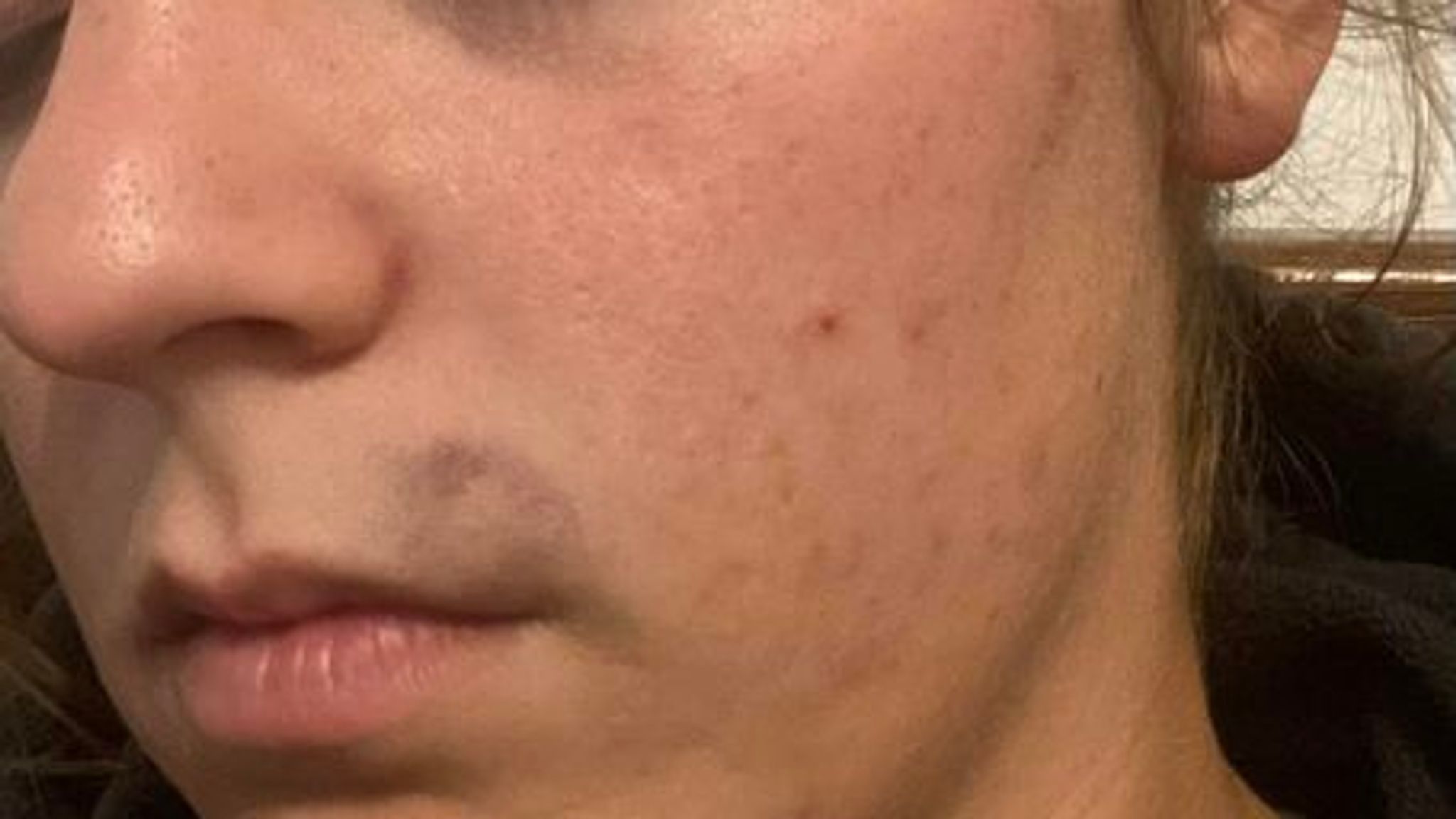Woman 'terrified' to return to downtown area after 'homophobic' attack ...