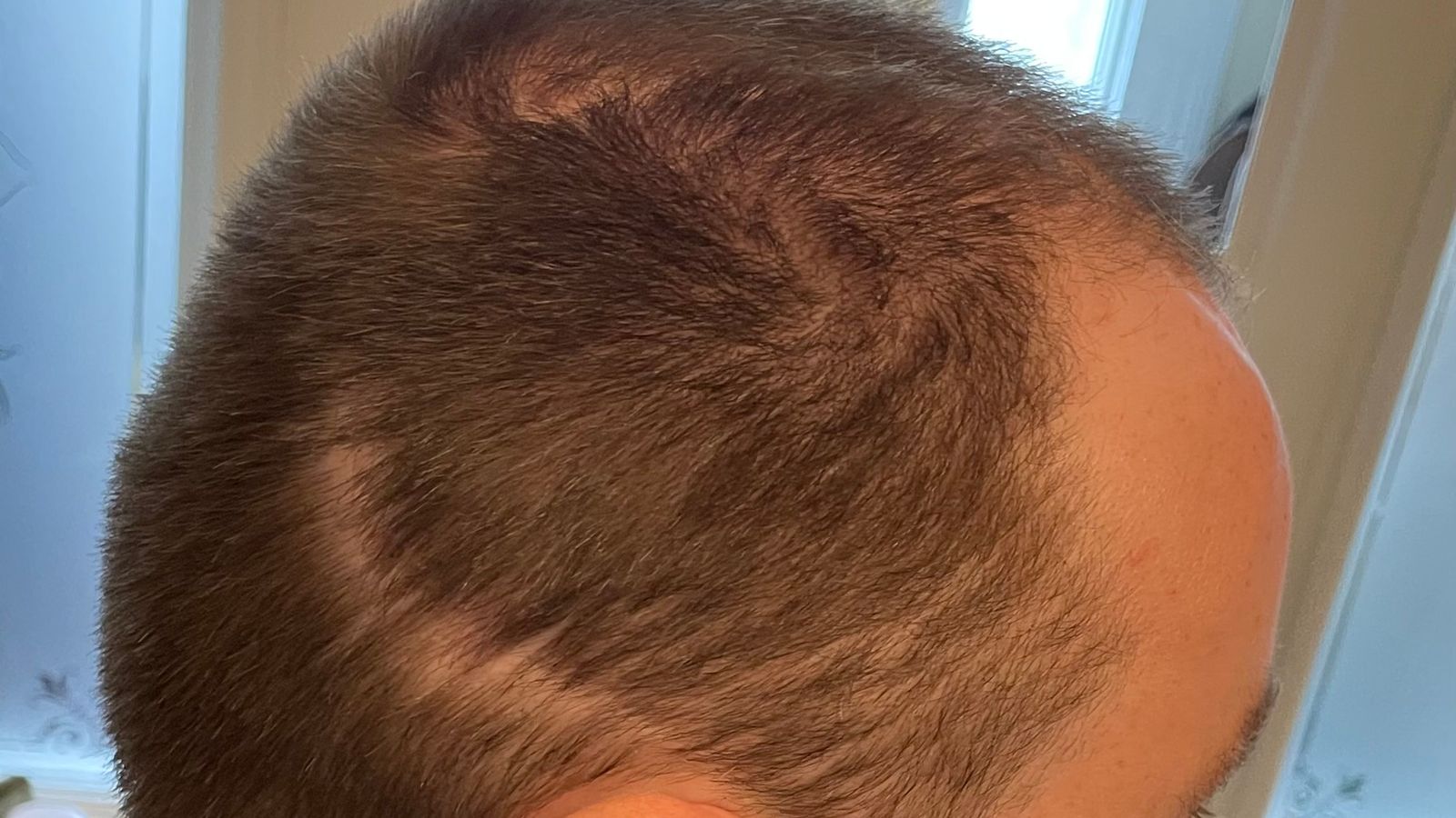 Man whose best friend was killed by paranoid schizophrenic dismayed by ...