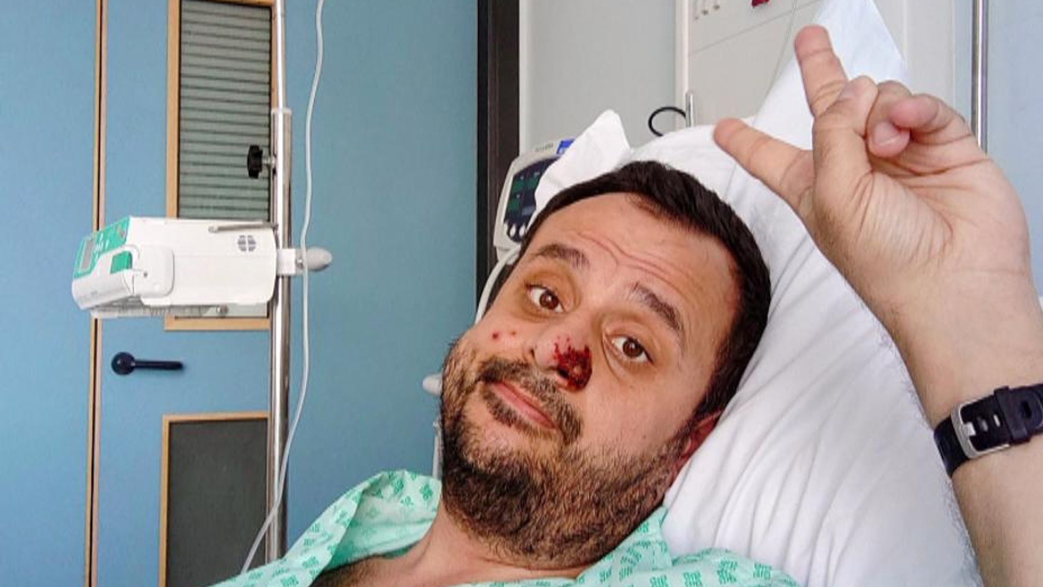 Man who contracted mpox describes 'horrendous' symptoms - as deadlier ...