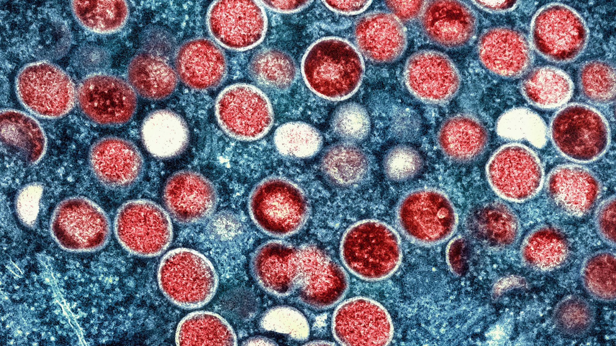 How does mpox spread and what is the risk to the rest of the world ...