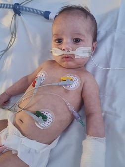 Measles: Mum urges parents to vaccinate children after baby left 'struggling to breathe' | UK ...