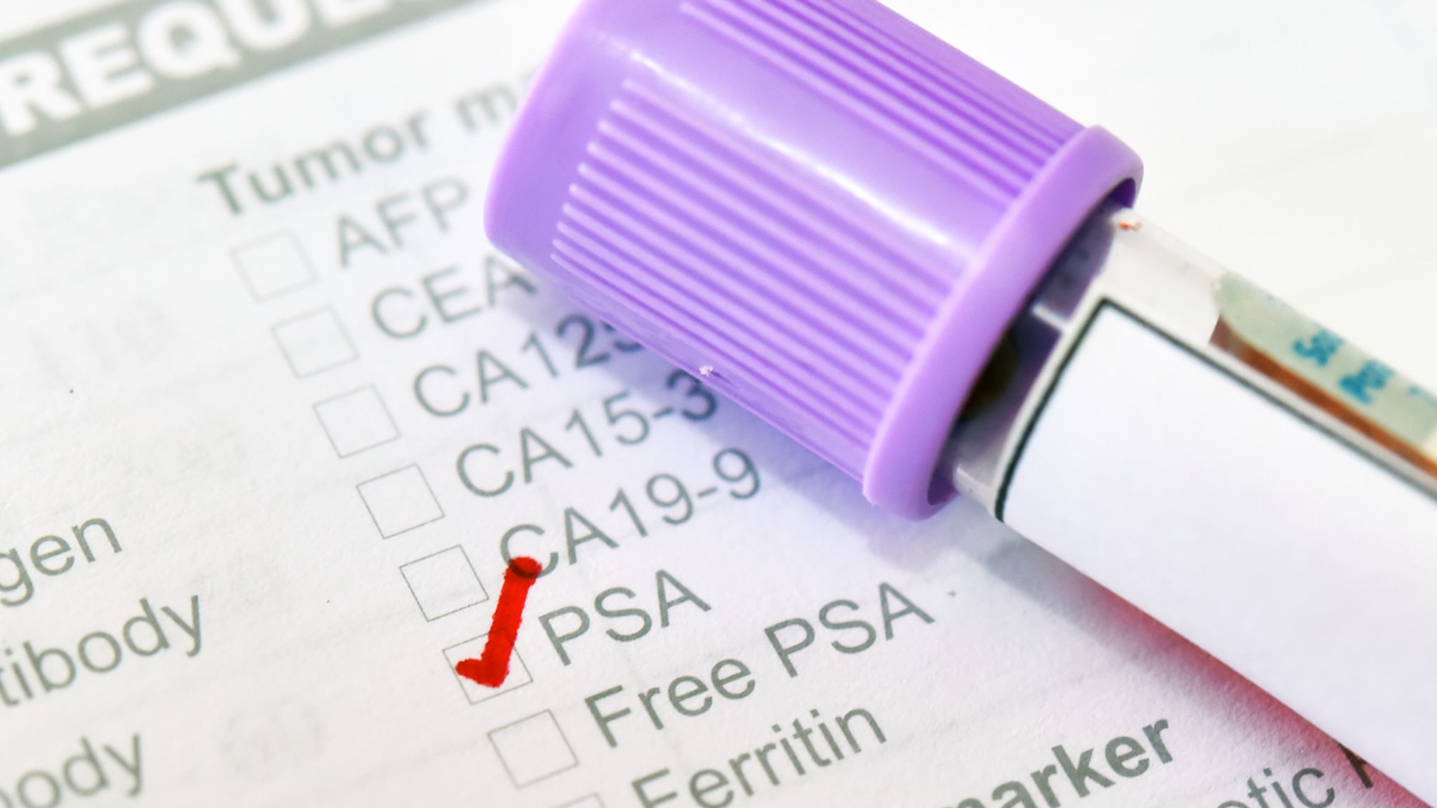 Prostate cancer test shown to 'reduce number of deaths' - as charity ...