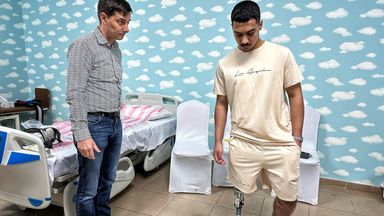 'The doctor told me count to three - and he cut my leg': The generation ...