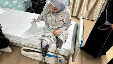 'The doctor told me count to three - and he cut my leg': The generation ...