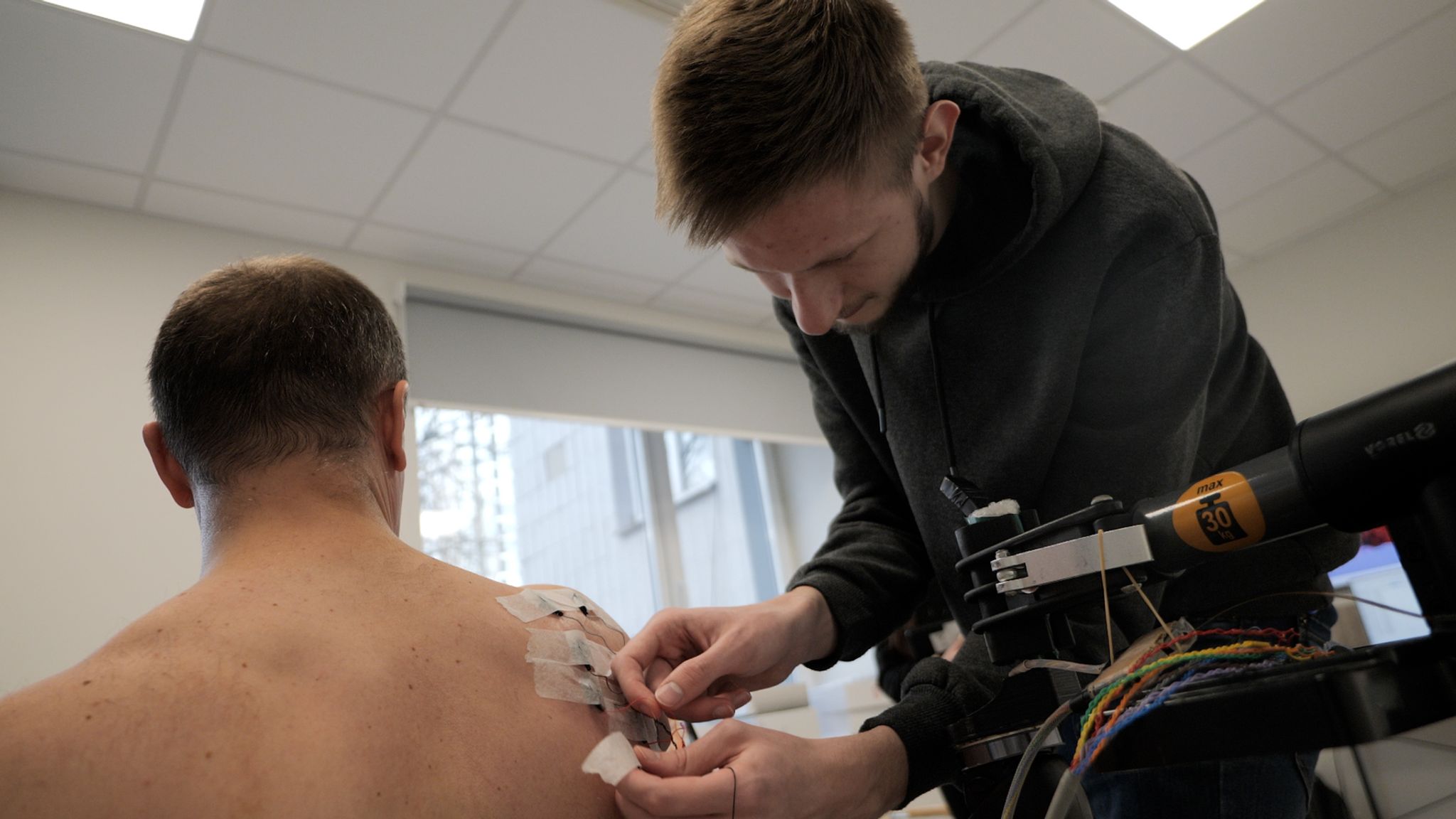 How Bionic Limbs Are Helping Ukrainian Troops Injured In War World