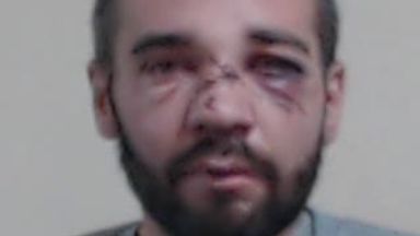 Finlay MacDonald: Man who went on shooting and stabbing spree in Skye ...