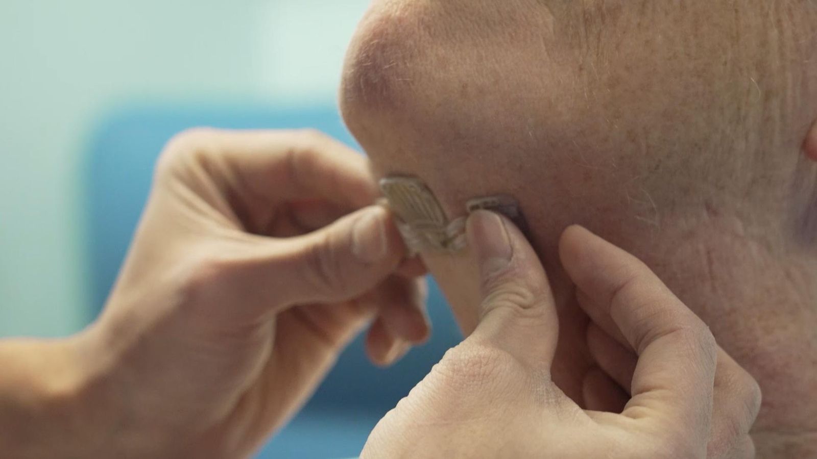 How electronic chips are helping obstructive sleep apnoea sufferers ...