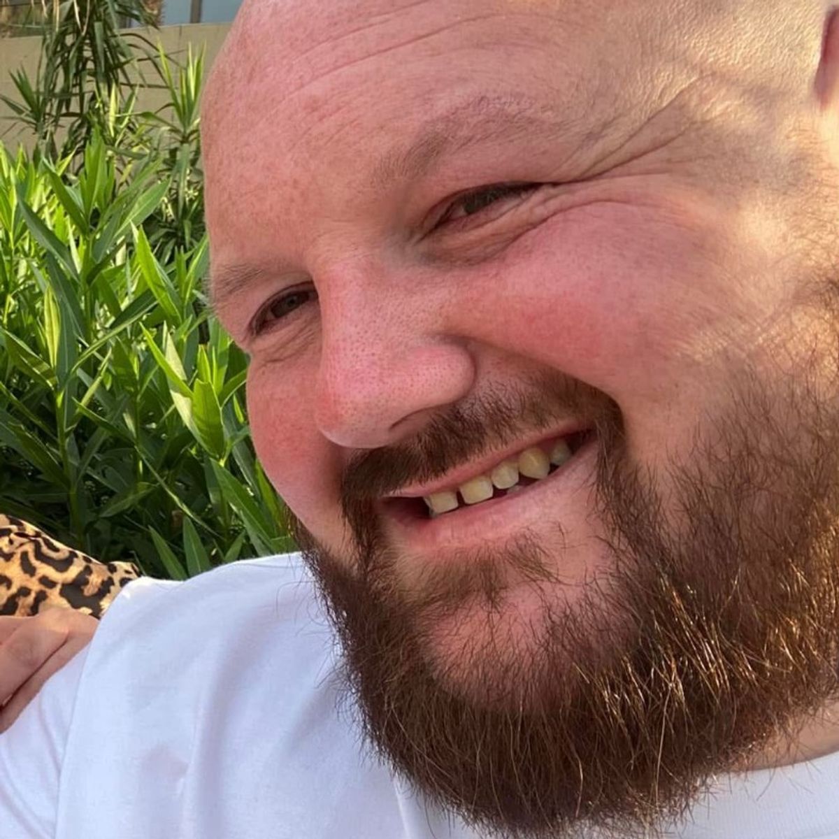 Battery acid attack victim reveals how donated placenta treatment saved ...