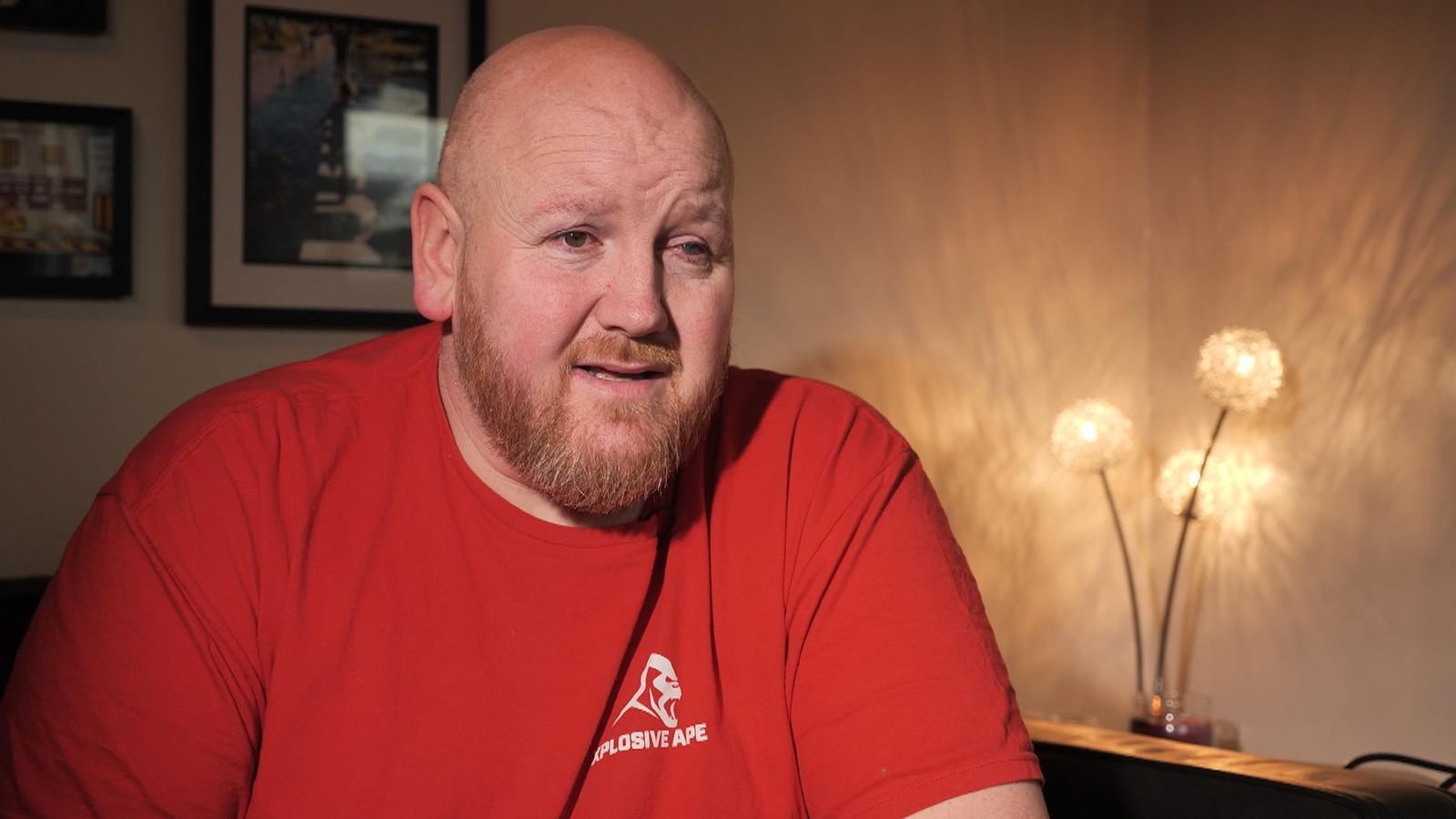 Acid attack victim's eye saved by donated placenta treatment | UK News ...