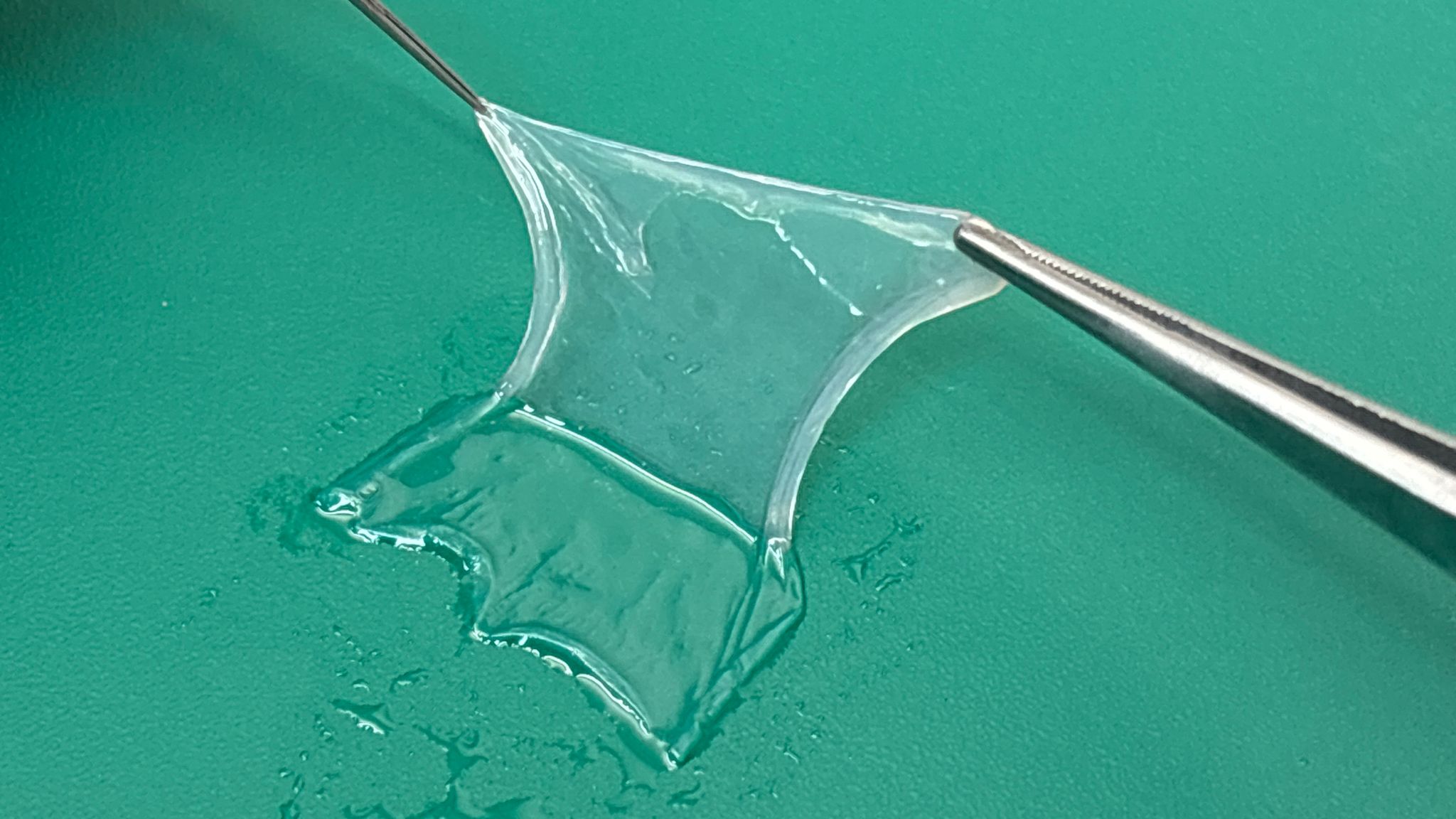 Battery acid attack victim reveals how donated placenta treatment saved ...