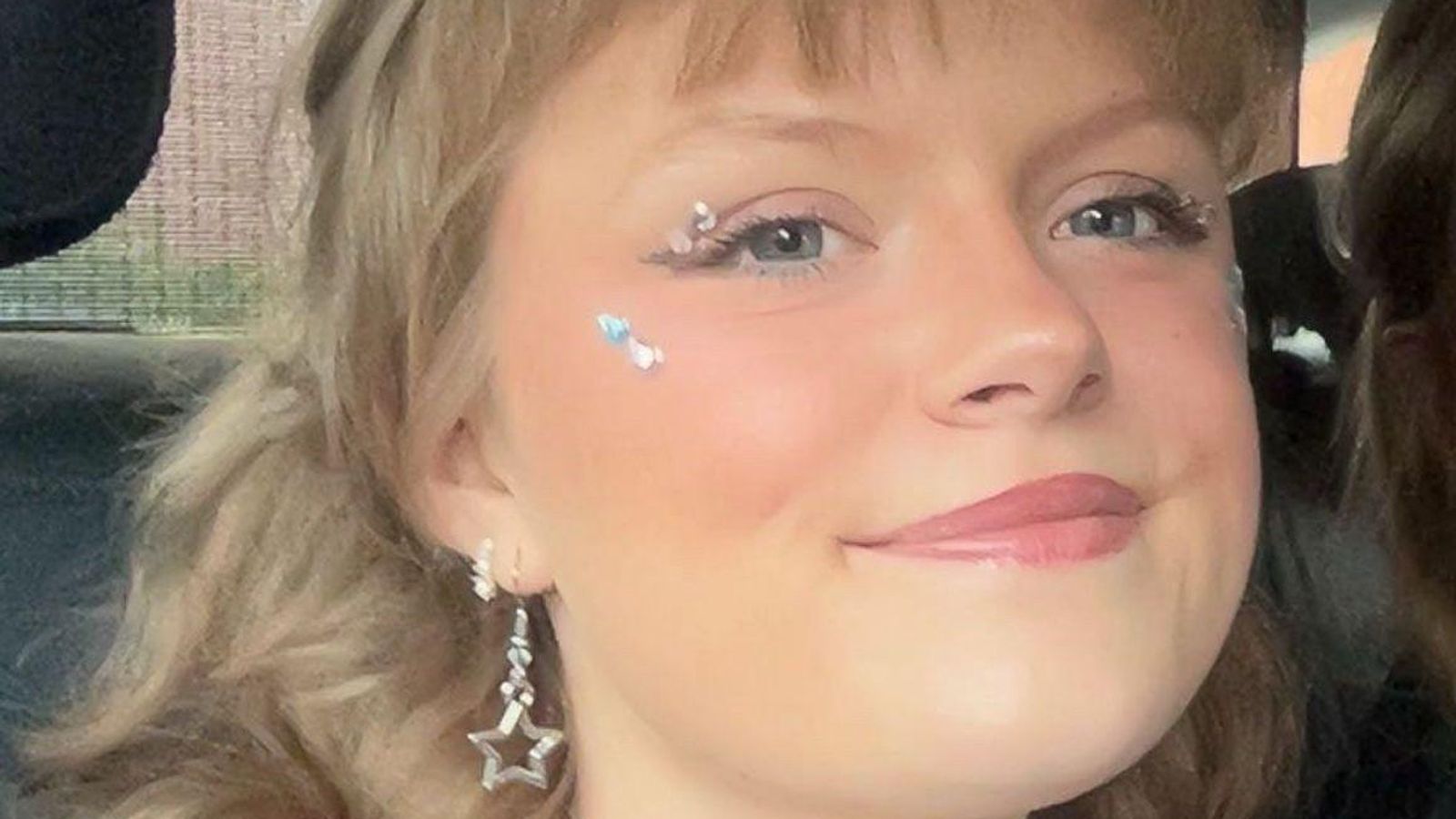 Teenager had part of skull stored in her stomach after rare brain bleed ...