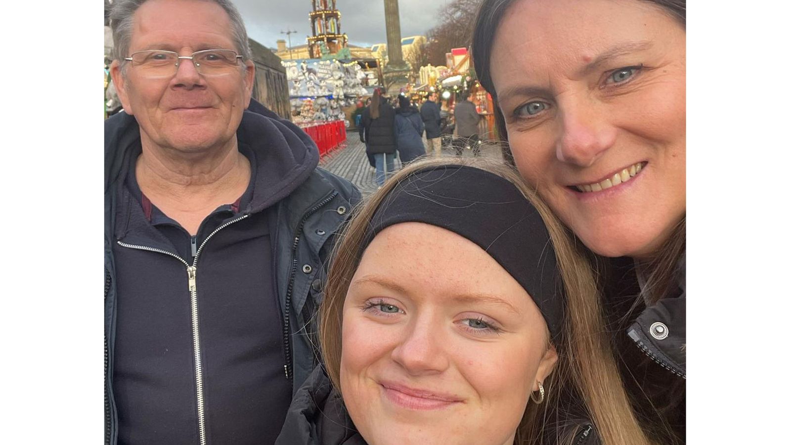 Teenager had part of skull stored in her stomach after rare brain bleed ...