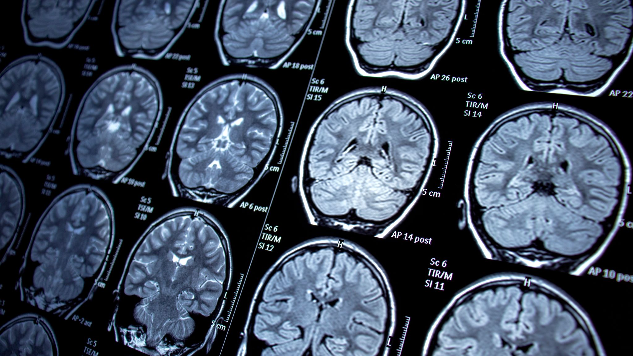 'I'm a brain surgeon - here's what we earn, how to keep your mind ...