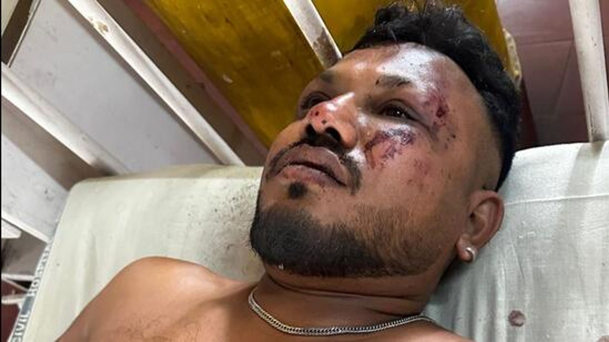 British crash survivor told family 'I don't know how I'm alive' seconds after plane came down ...