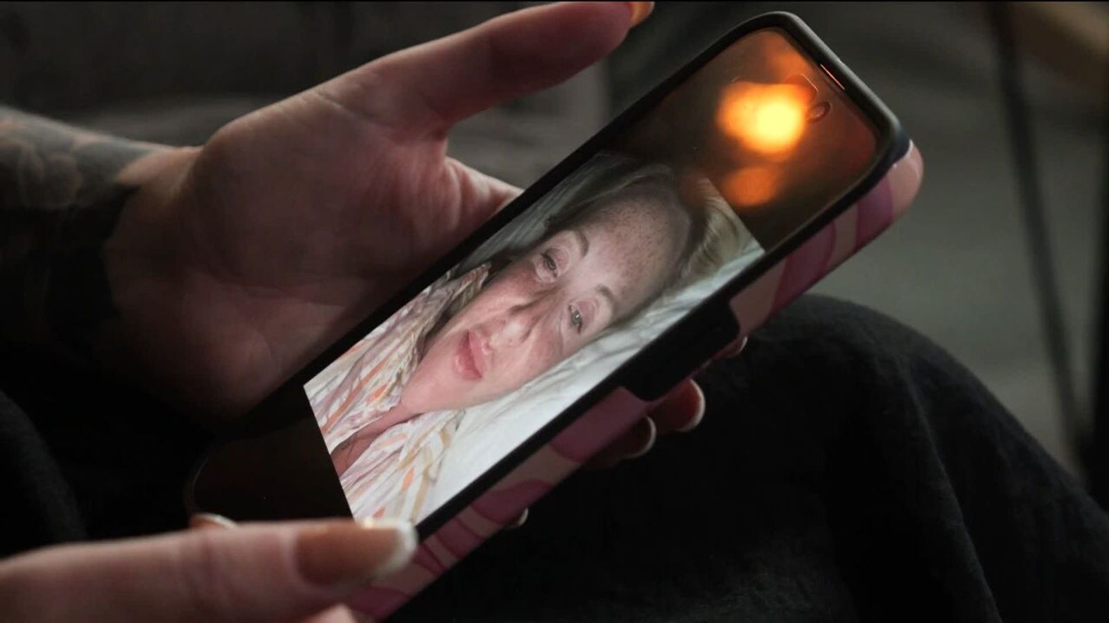 Unlicensed Botox-like injections spark outbreak of rare, life ...