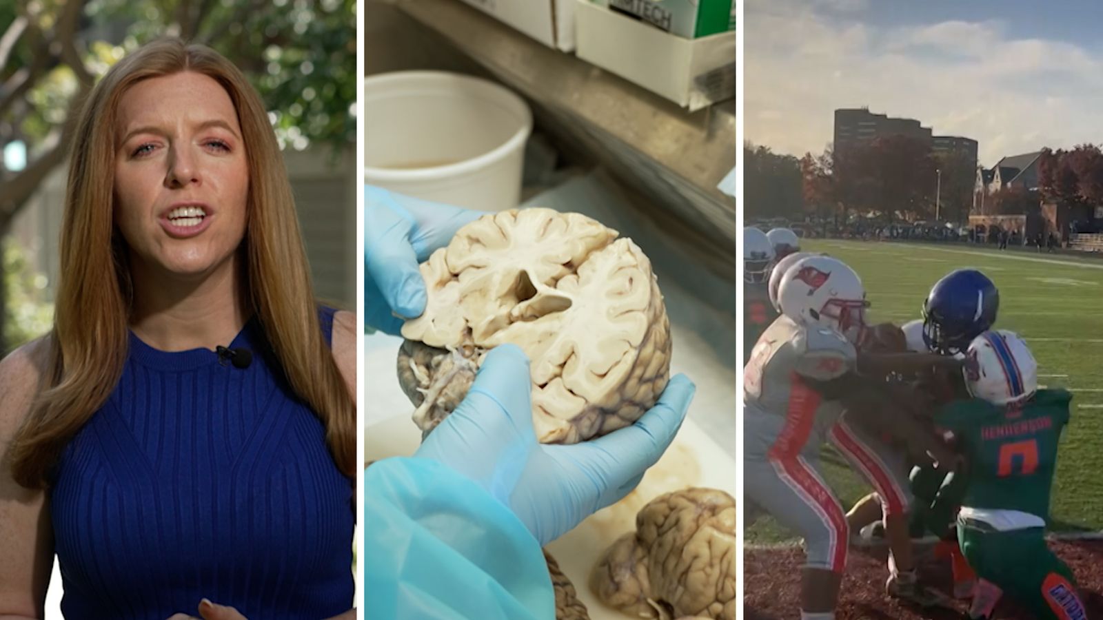 What is CTE - the brain disease the New York shooter claims he had ...