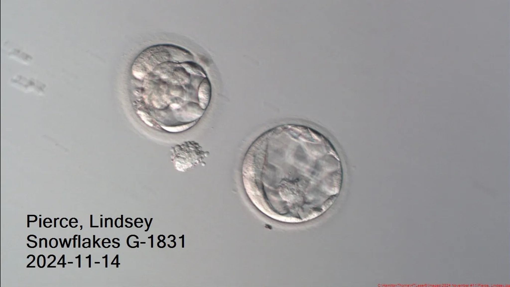 Record-breaking baby born from oldest ever embryo | Science, Climate ...