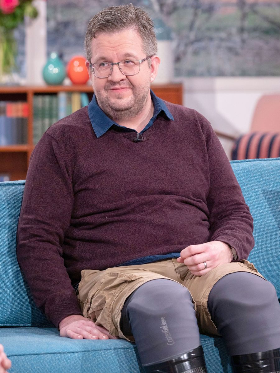 NHS surgeon jailed for fraud over amputation of own legs for 'sexual ...