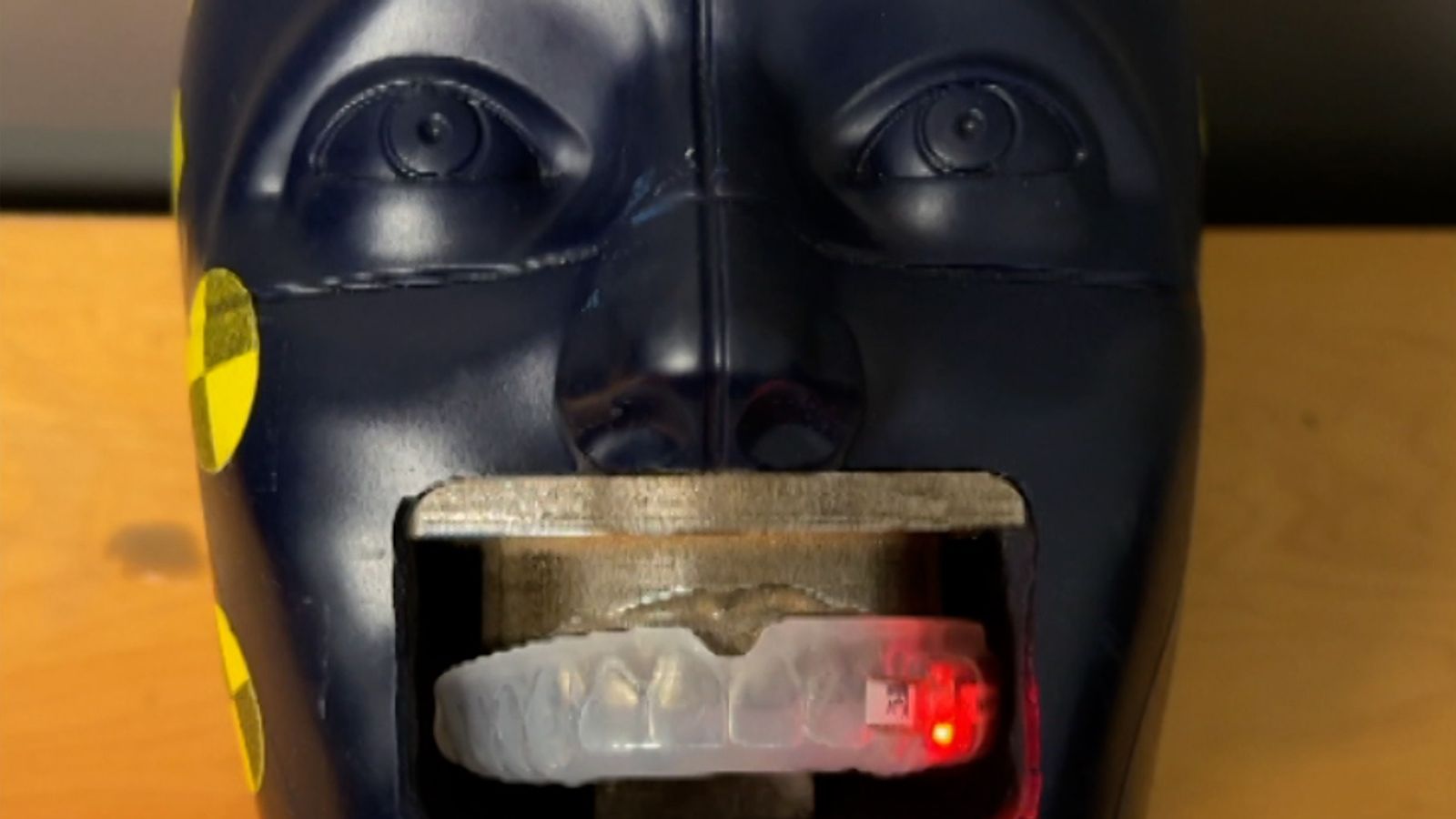 New mouthguard technology aims to detect head injuries in women's rugby ...