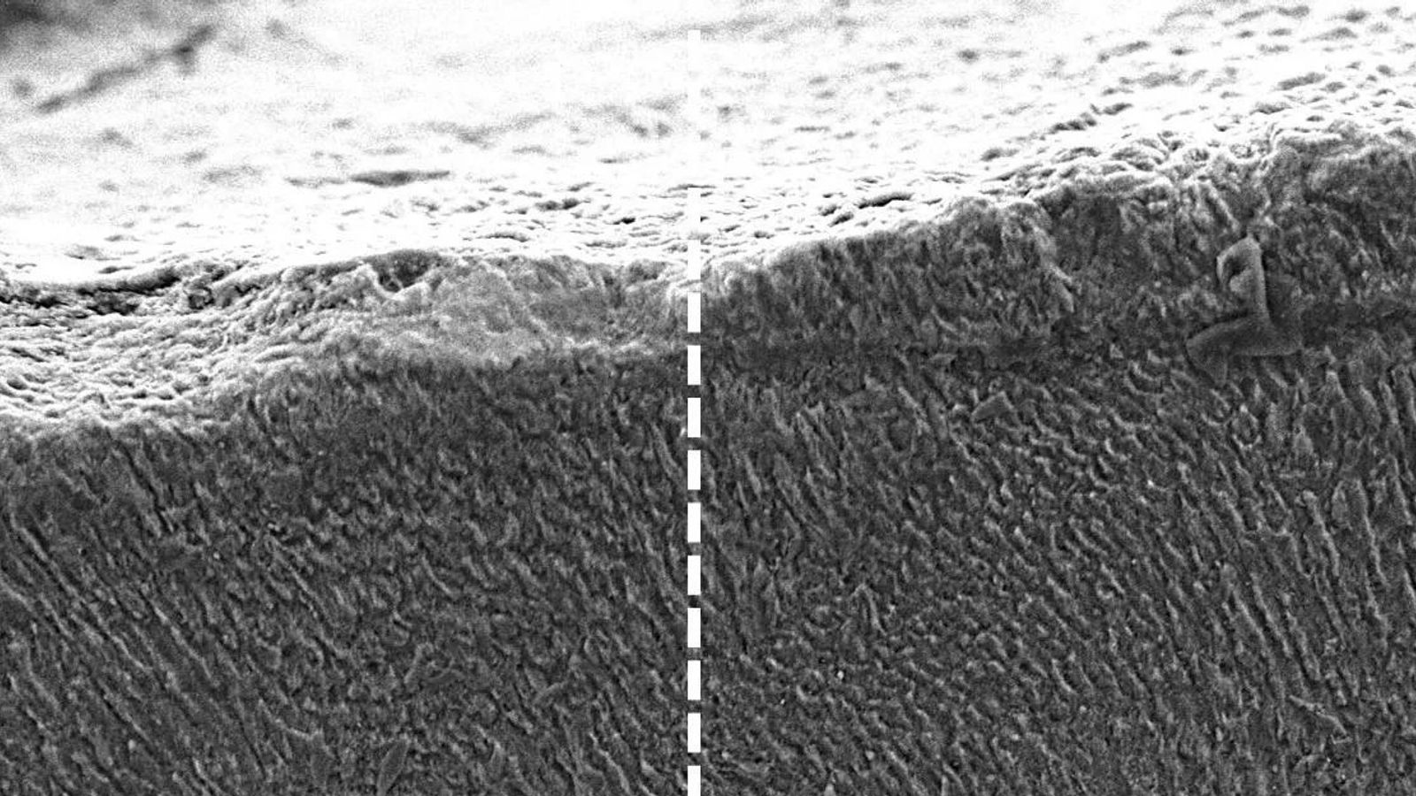 Toothpaste made with hair naturally repairs tooth enamel, scientists ...