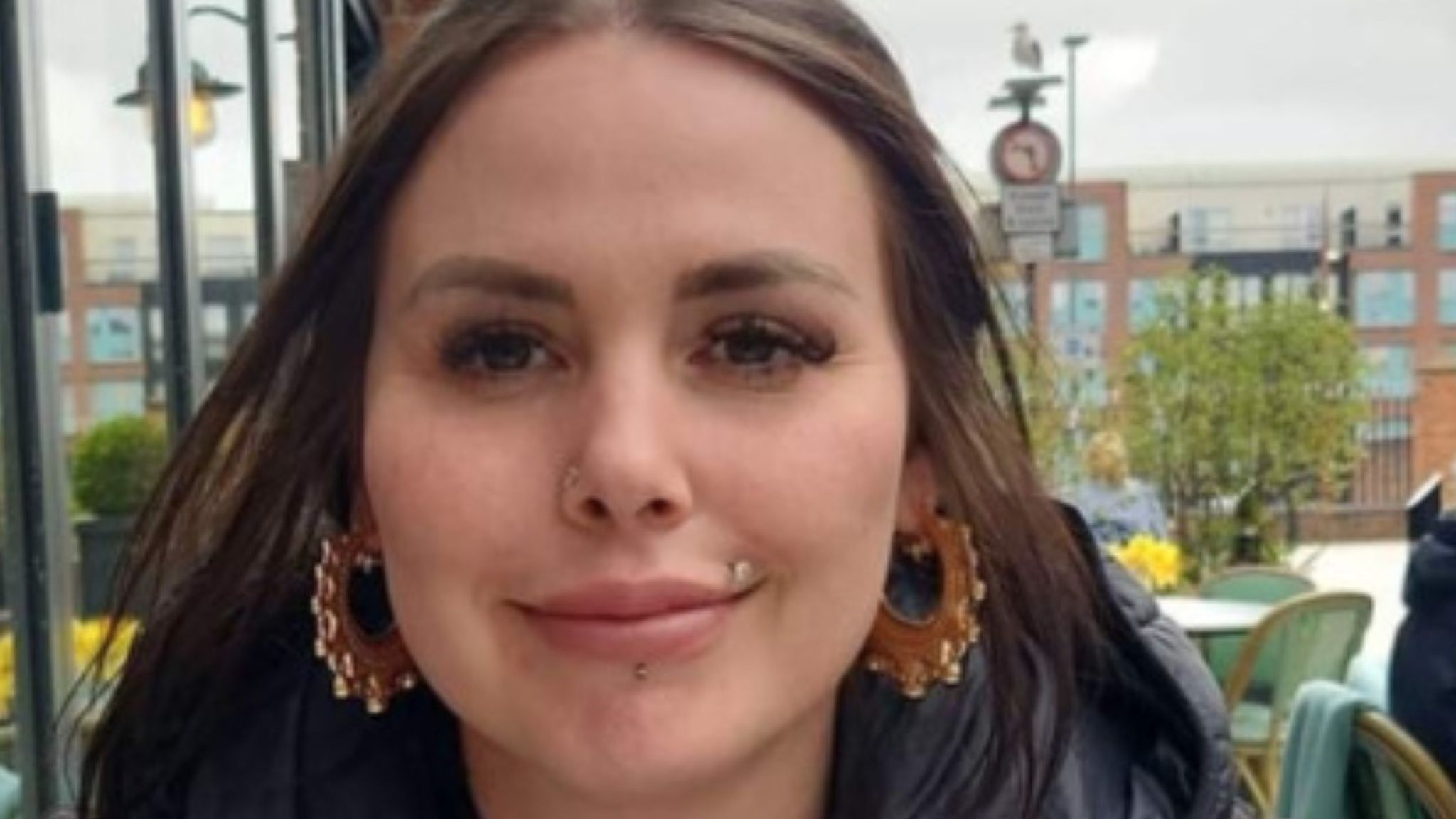 Woman told she may have to lose leg to stay alive after liquid ...