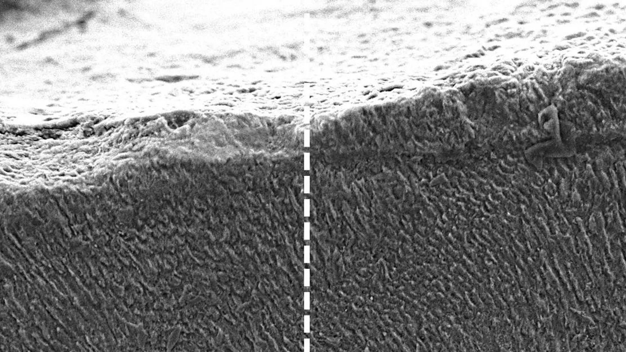 Toothpaste made with hair naturally repairs tooth enamel, scientists ...