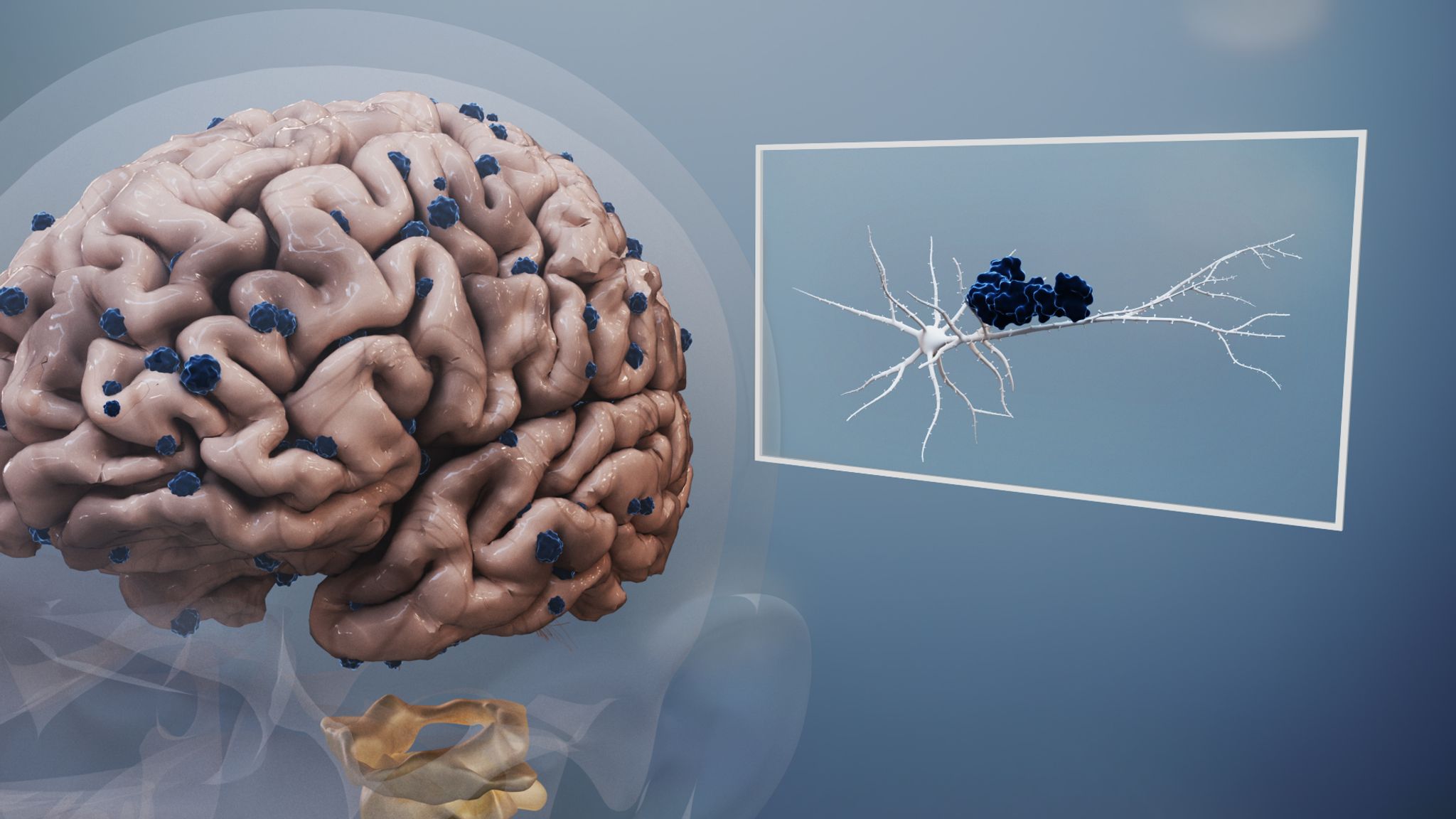 Brain Cadaver Superior
