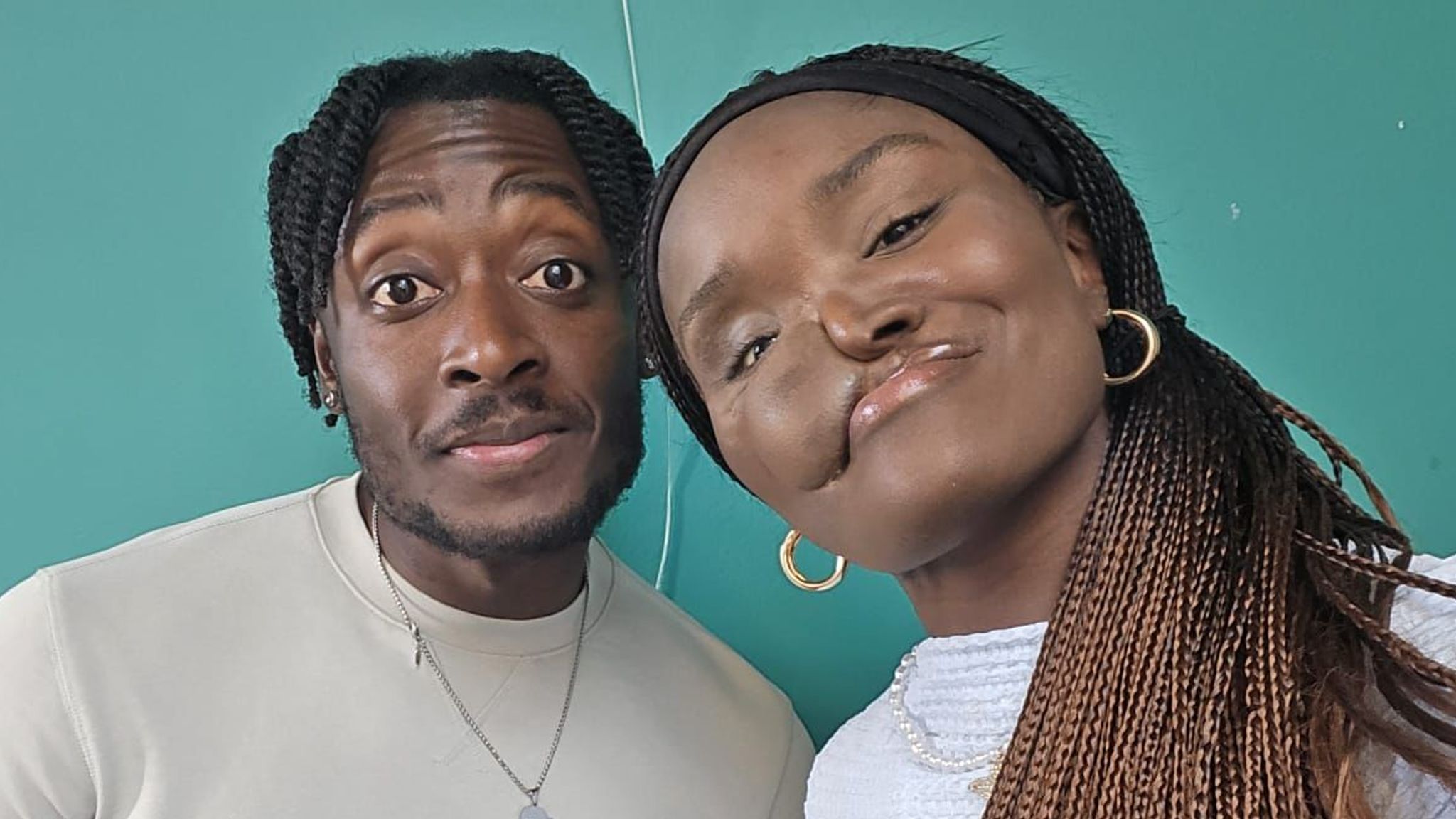 What if Romeo had a scar? Or Juliet a facial difference? The actors ...