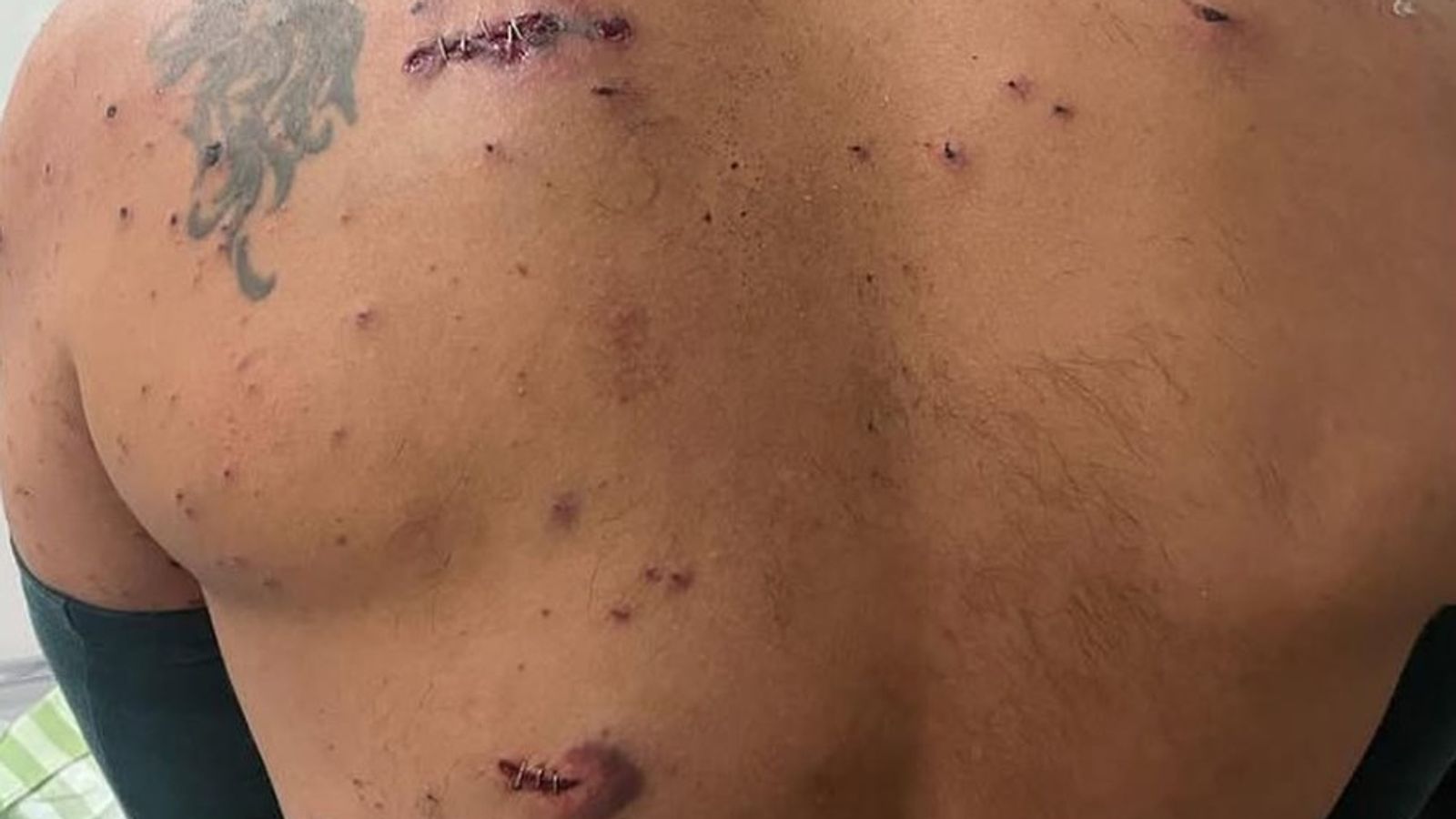 Nova festival survivor dies two years after girlfriend shot dead as he ...