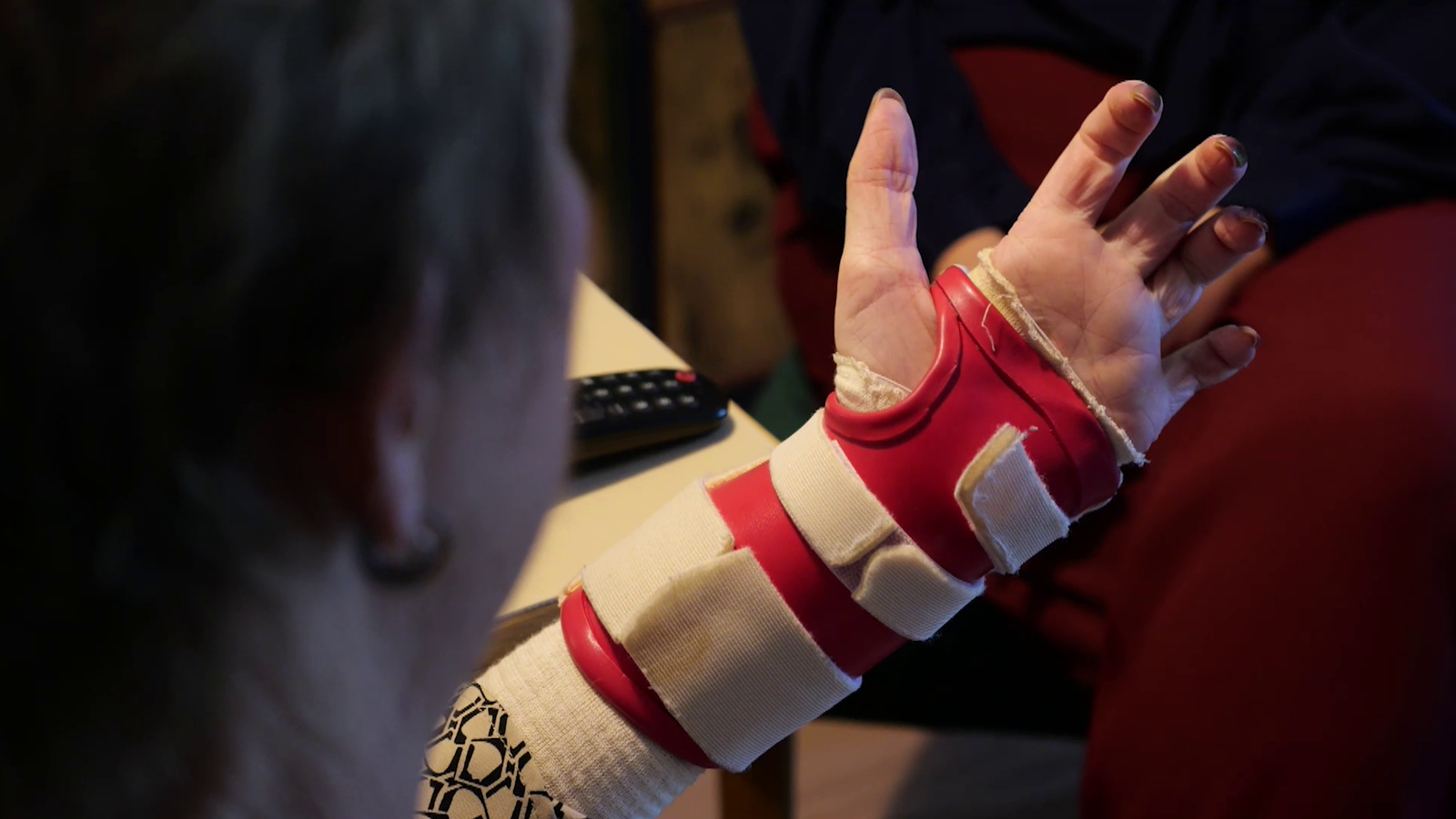 'I can't believe it's real': What it's like to get hand transplant | UK ...
