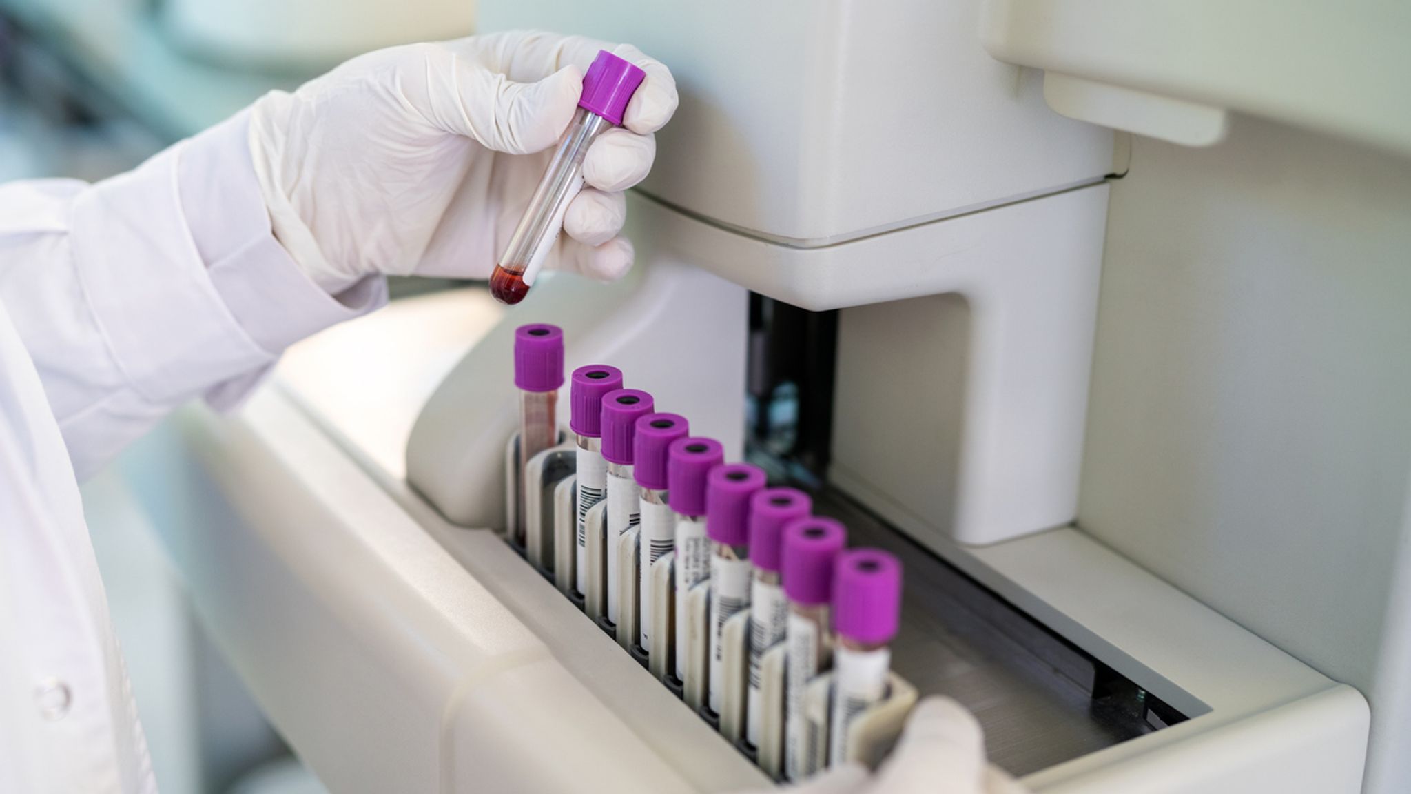 Blood test could detect Alzheimer's signs 'decades before symptoms ...
