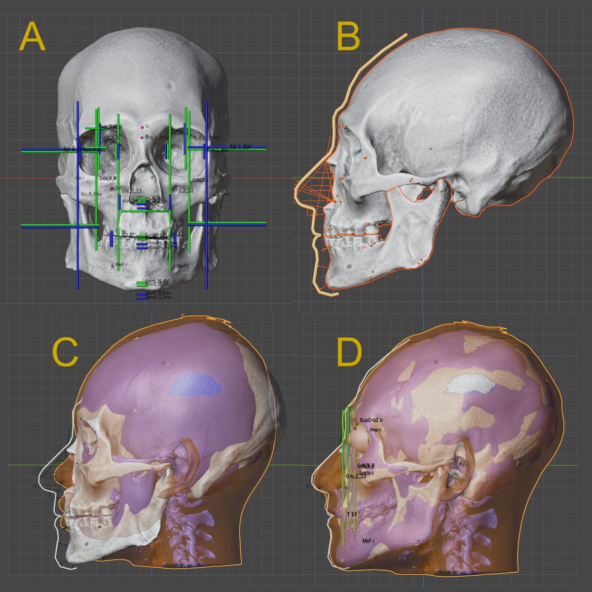 Meet the Kennewick Man: Face of 'most important' ancient American ...