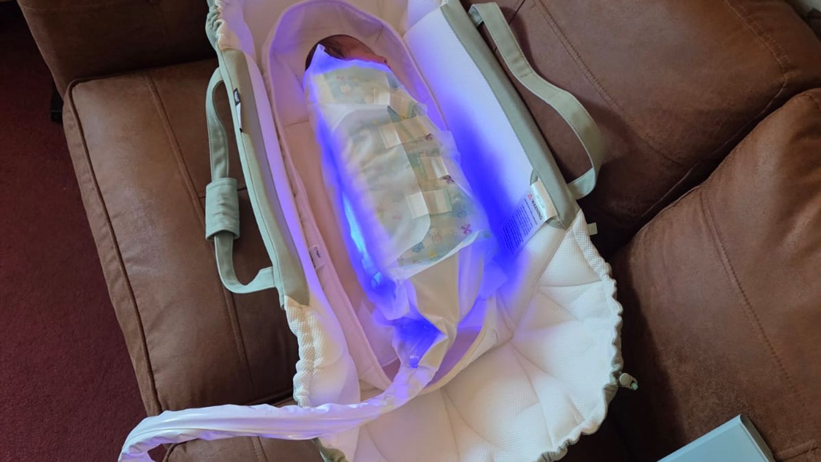 How newborns with jaundice can receive vital treatment at home | UK ...