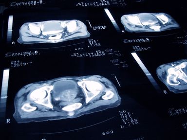 Cancer - The Latest News from the UK and Around the World | Sky News