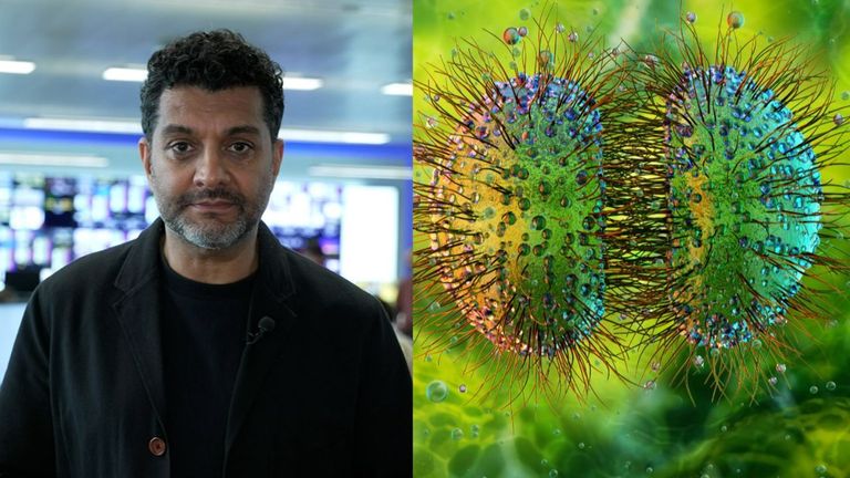 What you need to know about Dorset meningitis cases | UK News | Sky News