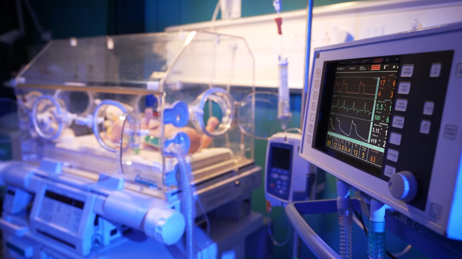 Breaking point: The UK's maternity crisis | UK News | Sky News
