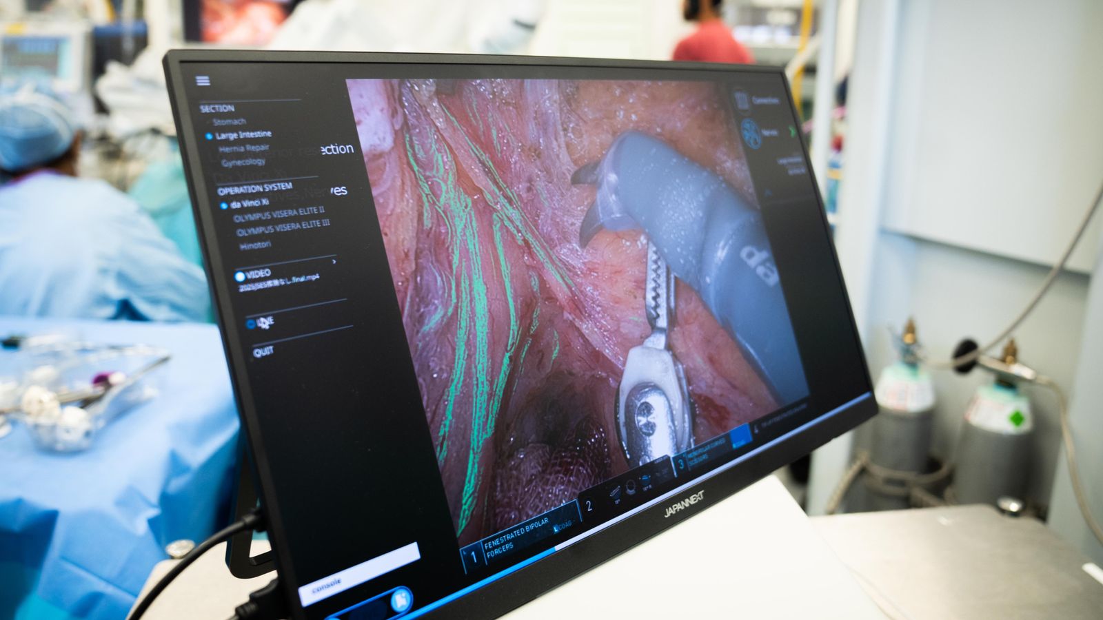 Surgeons in UK use new tool powered by AI for first time during live ...